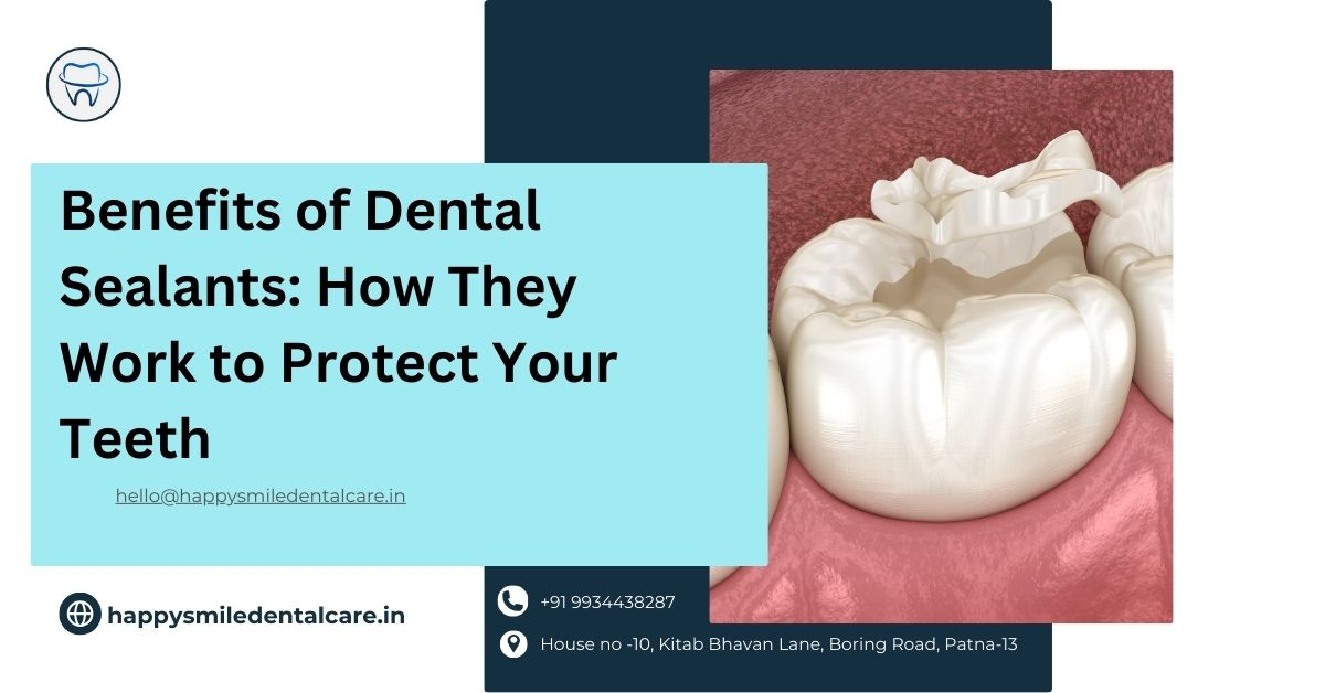 Benefits of Dental Sealants: How They Work to Protect Your Teeth ...