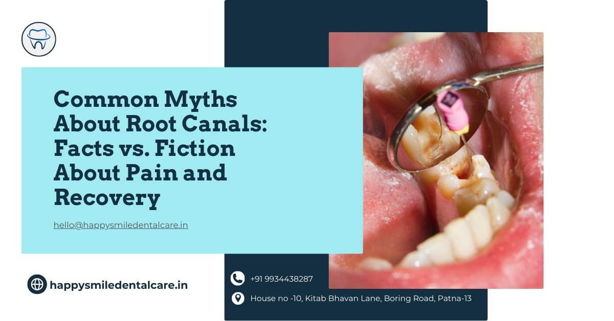 Common Myths About Root Canals: Facts vs. Fiction About Pain and Recovery - Happy Smile Dental ...