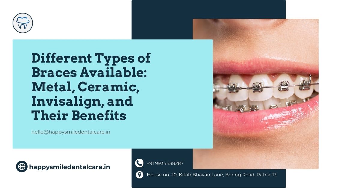 Different Types of Braces Available: Metal, Ceramic, Invisalign, and ...