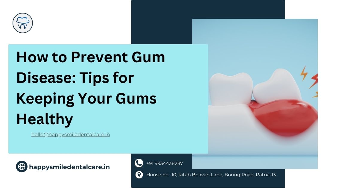 How to Prevent Gum Disease: Tips for Keeping Your Gums Healthy - HAPPY ...
