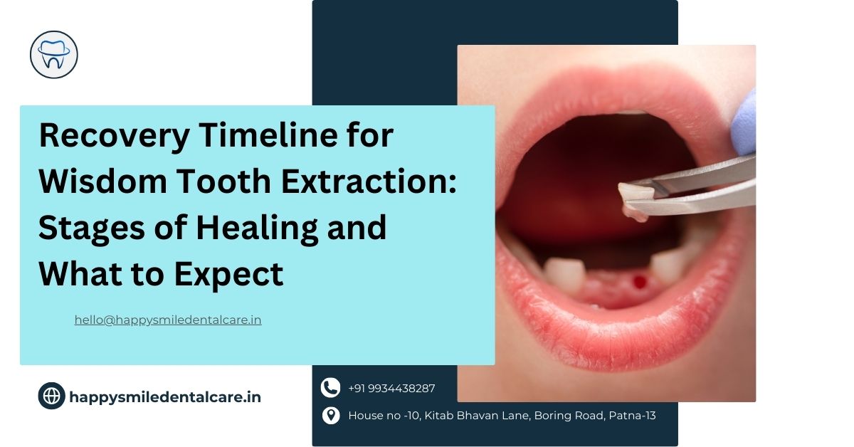 Recovery Timeline for Wisdom Tooth Extraction: Stages of Healing and ...