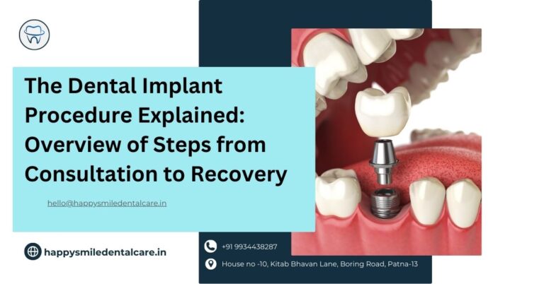 The Dental Implant Procedure Explained: Overview of Steps from ...