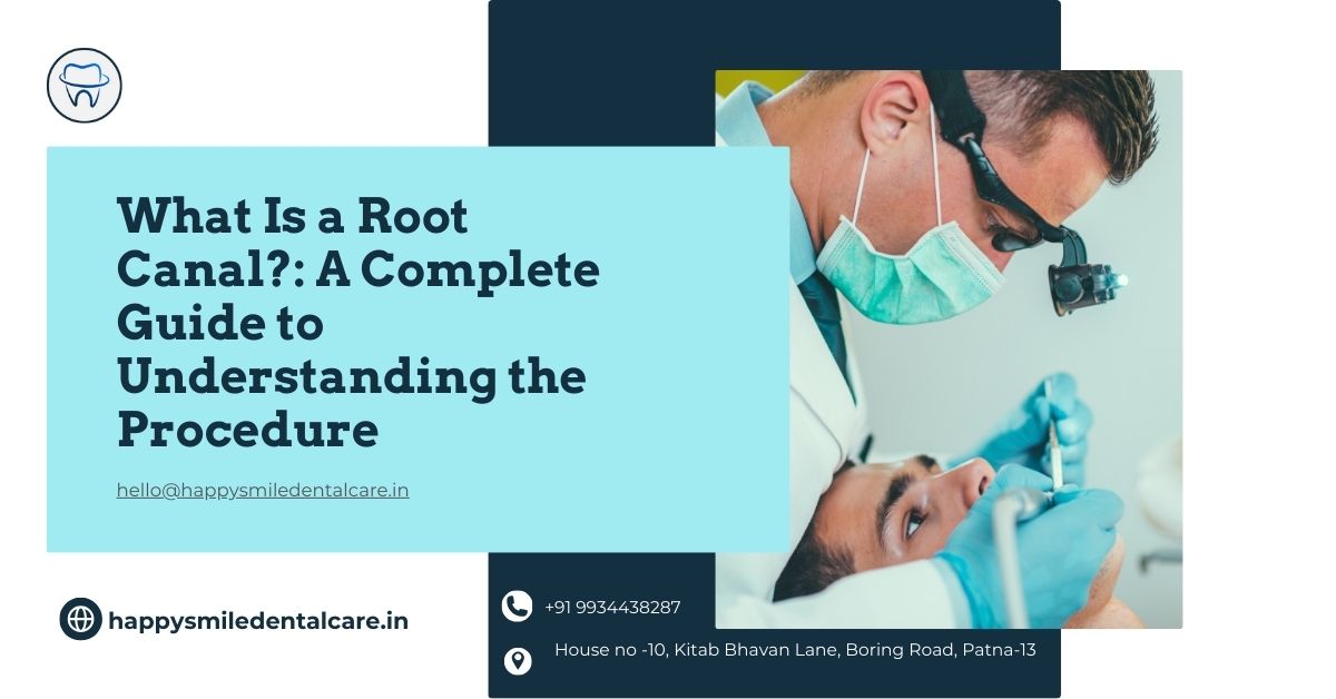 What Is a Root Canal?: A Complete Guide to Understanding the Procedure ...