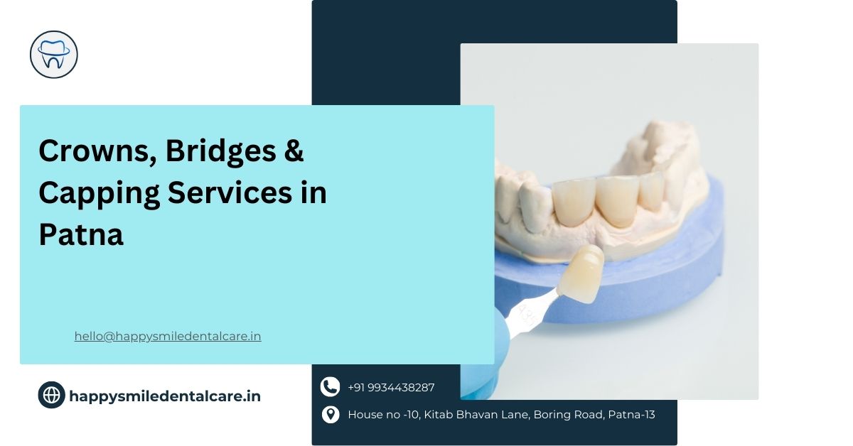 Crowns, Bridges & Capping Services in Patna - HAPPY SMILE DENTAL CARE