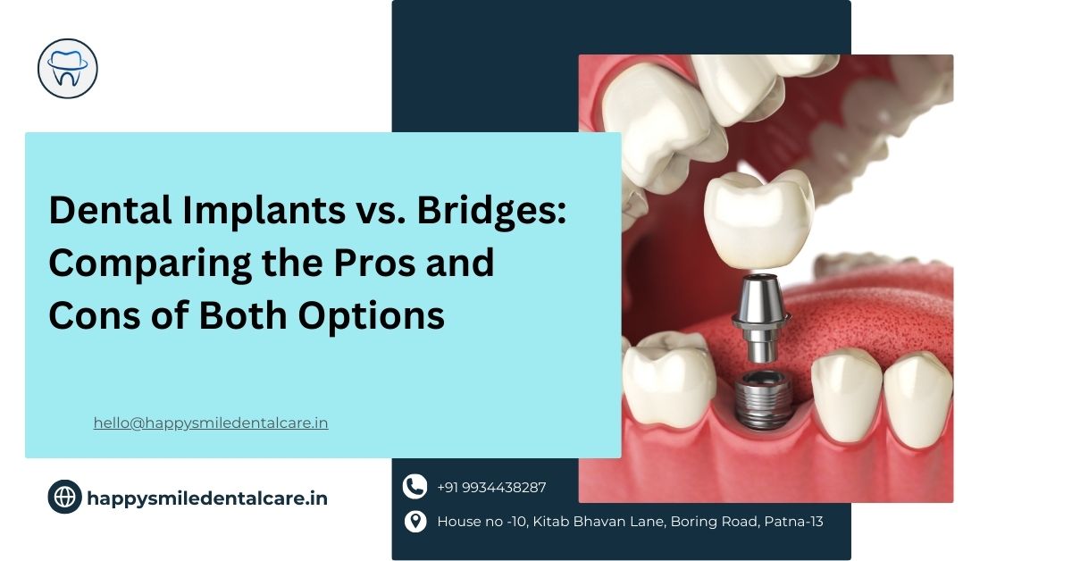 Dental Implants vs. Bridges: Comparing the Pros and Cons of Both Options - Happy Smile Dental ...