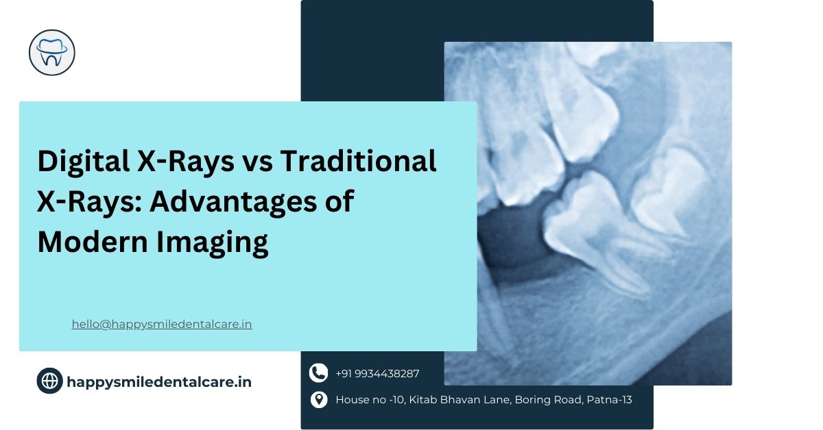 Digital X-Rays vs Traditional X-Rays: Advantages of Modern Imaging - Happy Smile Dental Care, Patna.